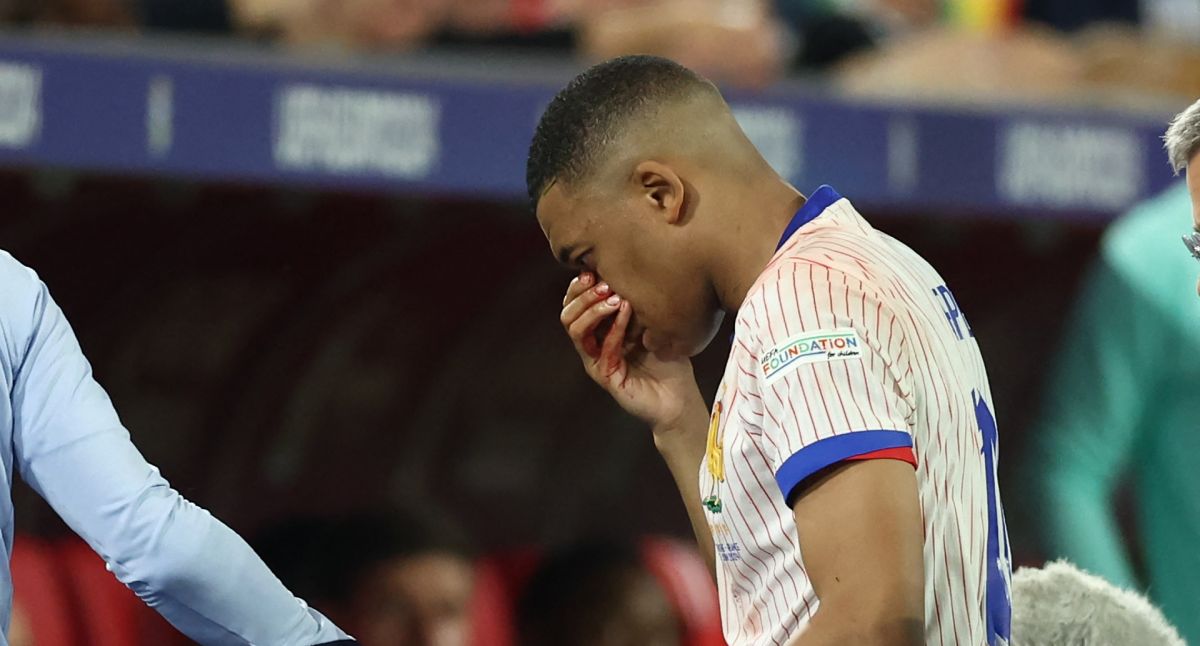 Kylian Mbappe set for surgery on broken nose