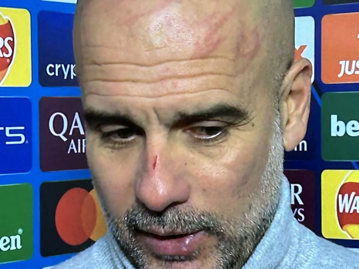 "I wanted to do myself damage" - Pep Guardiola appears in front of ...