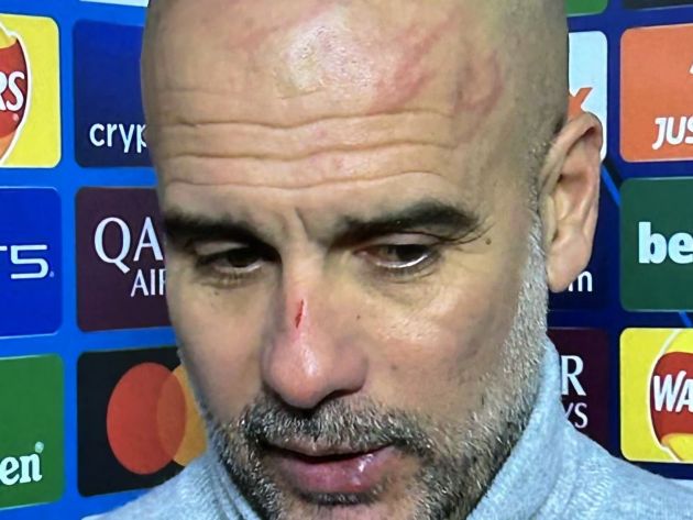 "I wanted to do myself damage" - Pep Guardiola appears in front of ...