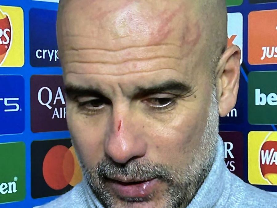"I wanted to do myself damage" - Pep Guardiola appears in front of ...